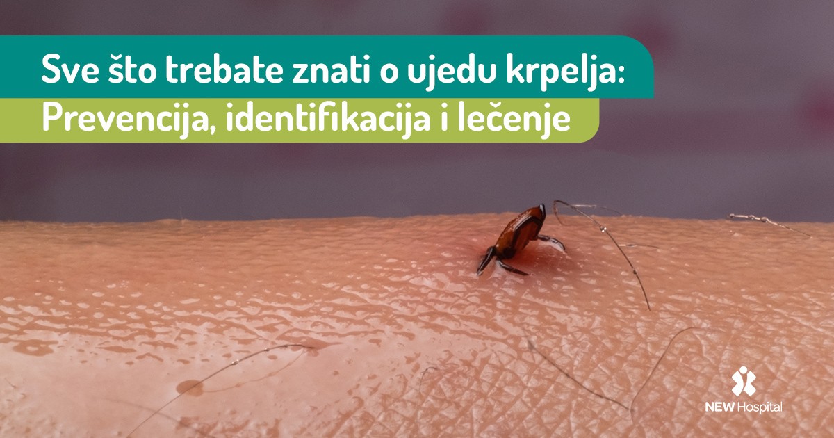 Sve što trebate znati o ujedu krpelja: Prevencija, identifikacija i ...